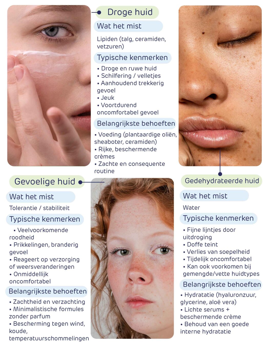 Droge en gevoelige huid: bescherm je whuidbarrière in de winter |Newpharma