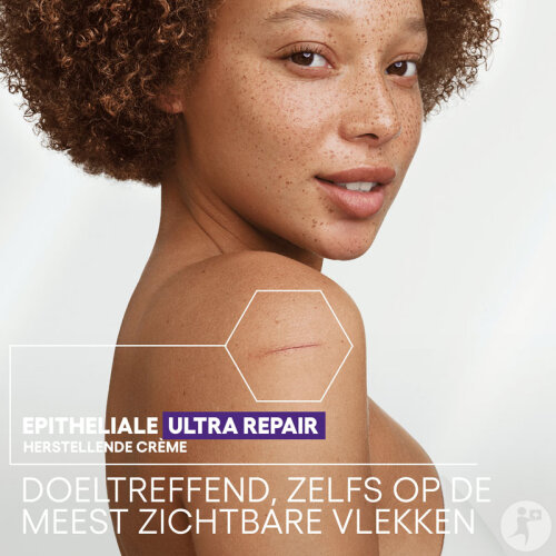 A-Derma Epitheliale Ultra Repair Herstellende Crème Tegen Littekens ...